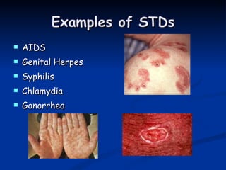 Piascy group discussion about abstainance | PPT