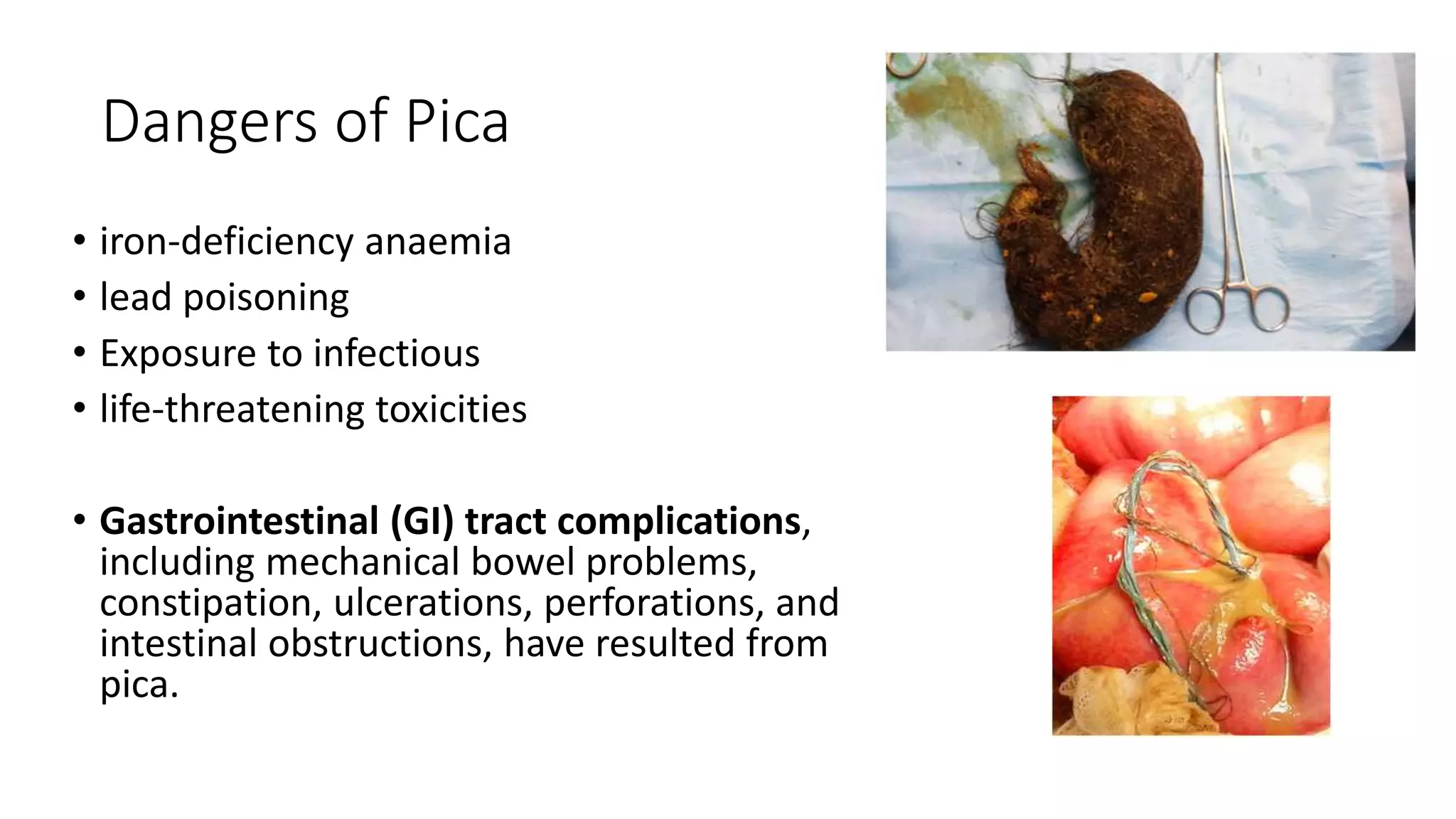 Pica disorder | PPTX