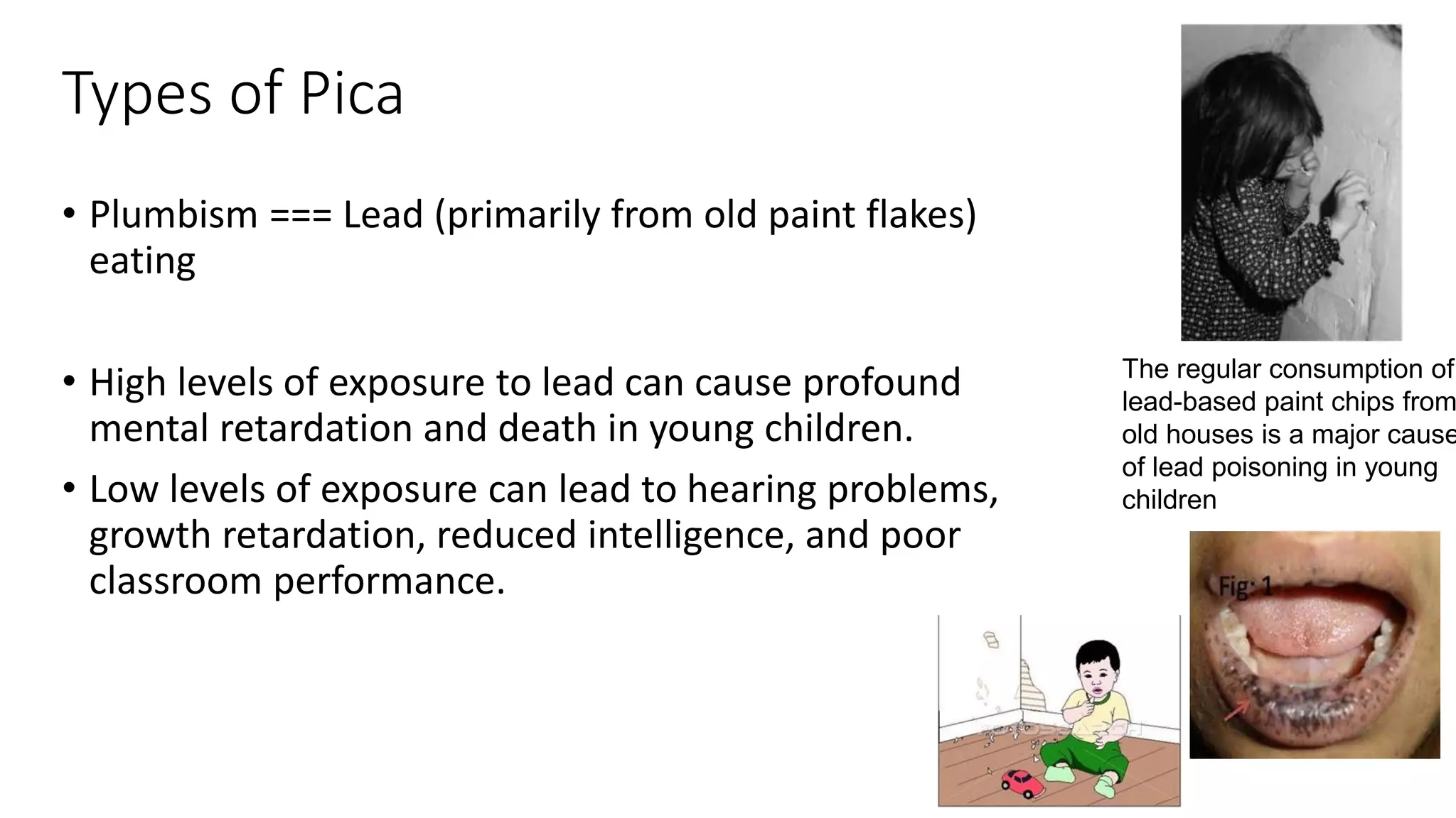 Pica disorder