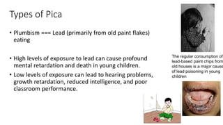 Pica disorder | PPTX