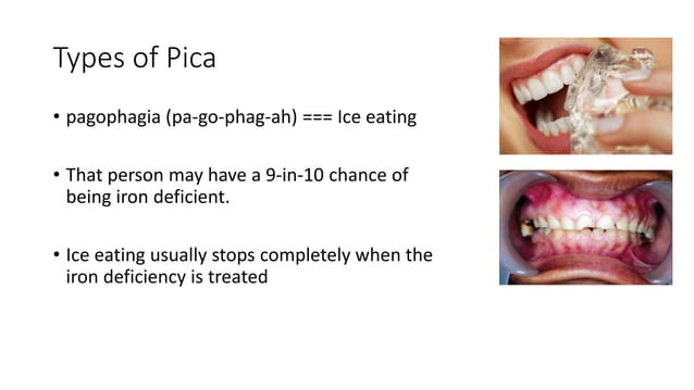 Pica disorder | PPTX | Digestive Disorders | Diseases and Conditions