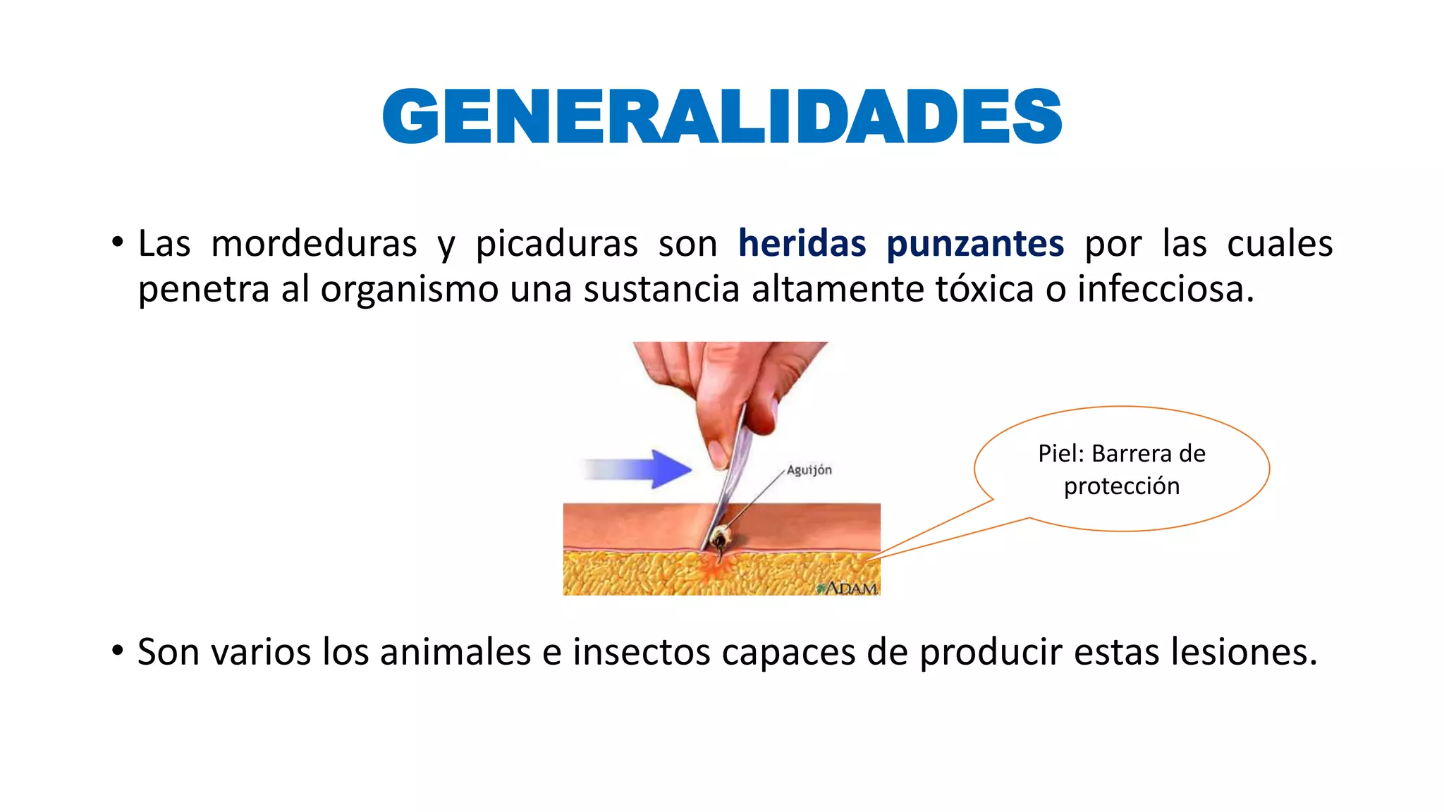 PICADURAS_Y_MORDEDURAS.pptx