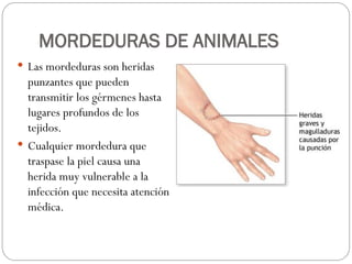 picaduras y mordeduras primeros auxilios.ppt