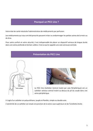 Infection Picc Line Recommandations – OVNI
