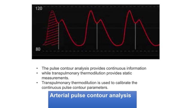 PiCCO Monitor | PPTX