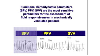 PiCCO Monitor | PPTX