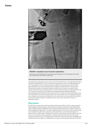 Piccolo Duct Occluder.pdf | Heart and Cardiovascular Diseases ...