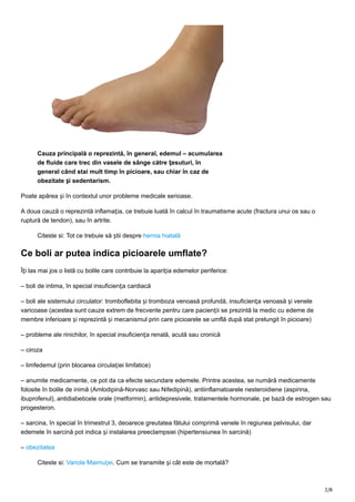 Ceaiuri pentru picioare umflate | alternamed.ro