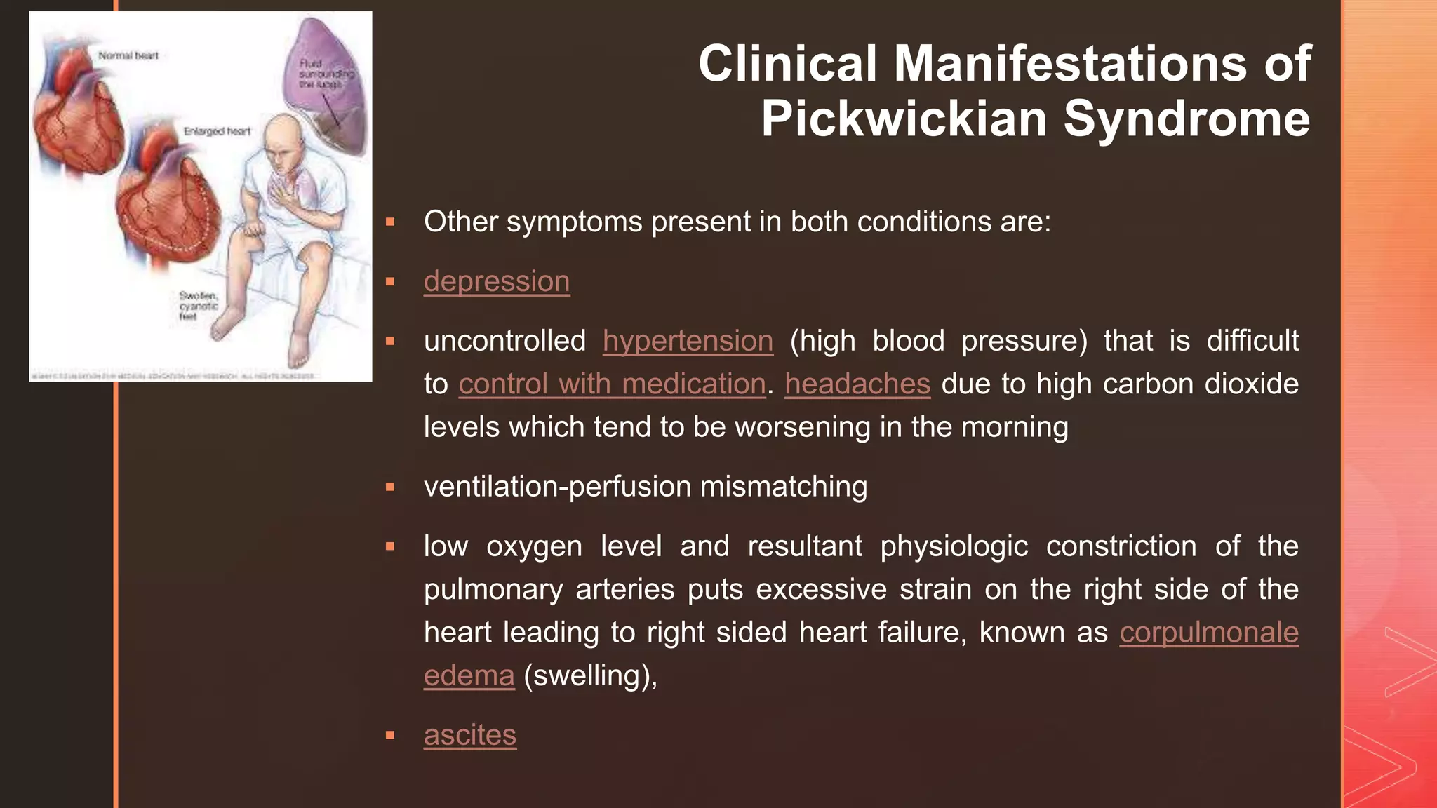 Pickwickian syndrome | PPTX