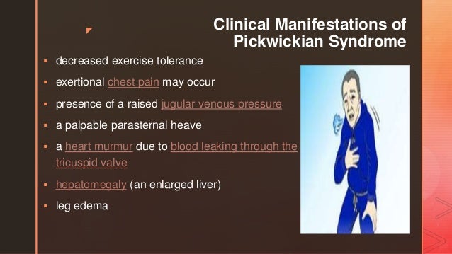 Pickwickian syndrome