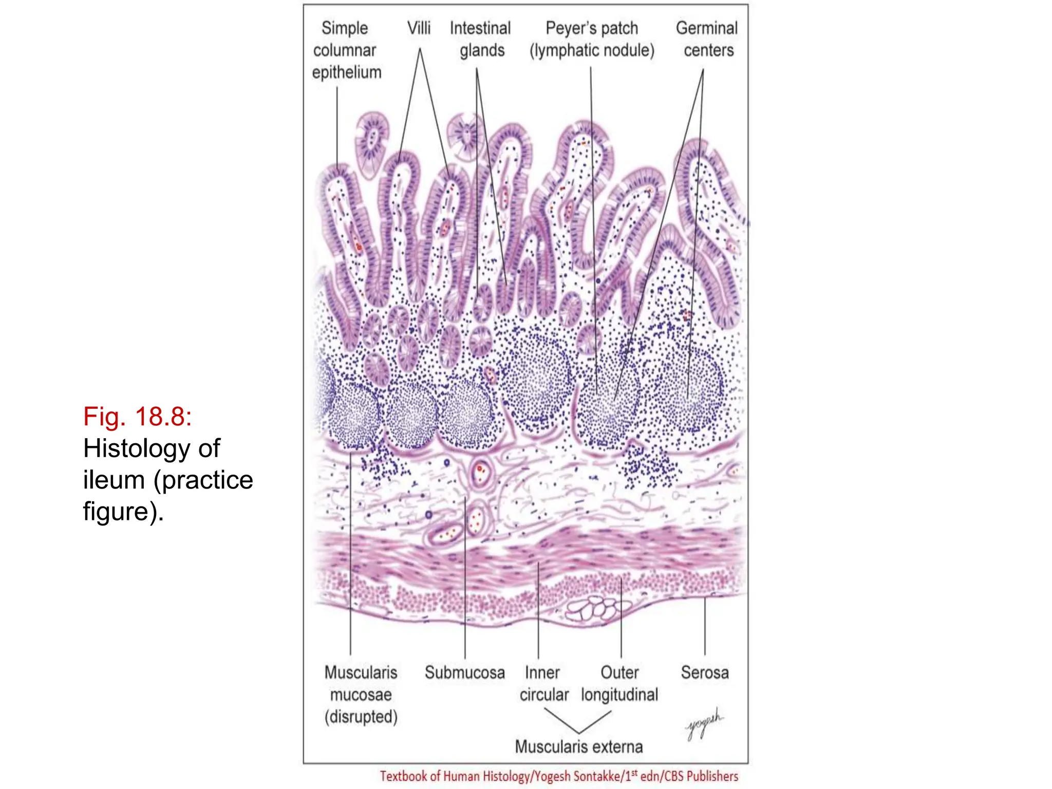 PIC OF HISTPOLOGY DU JEJUNUM ILEUM.pptx