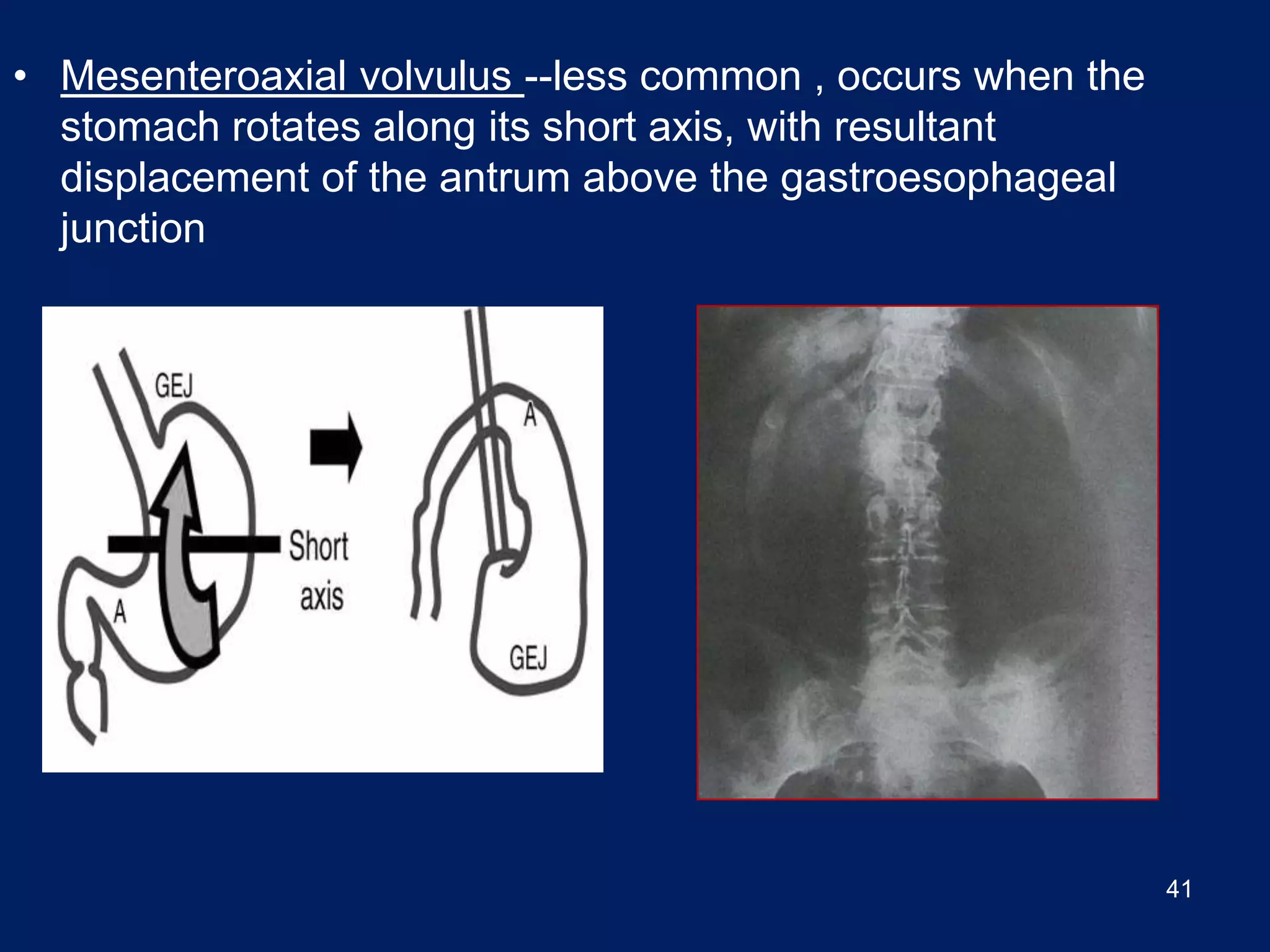 Pictures of acute abdomen.pdf