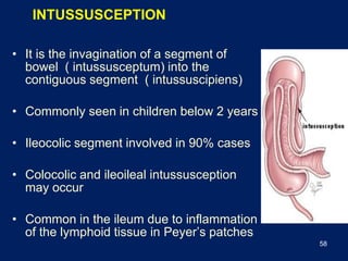 Pictures of acute abdomen.pdf