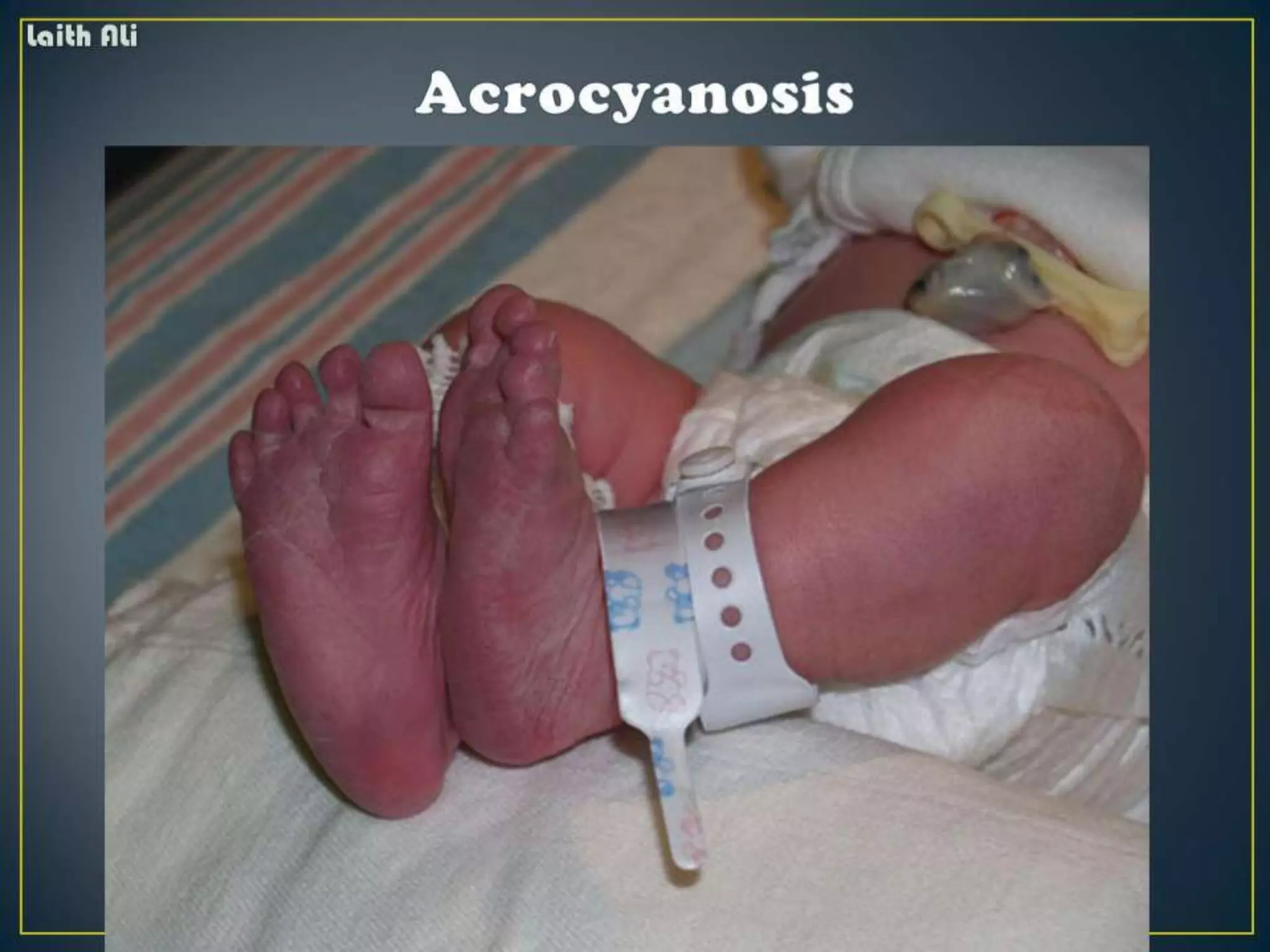 Pictures of pediatric disorders | PPSX