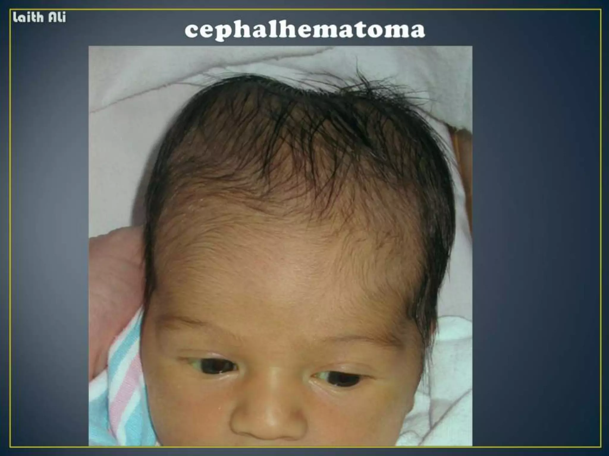 Pictures of pediatric disorders | PPSX