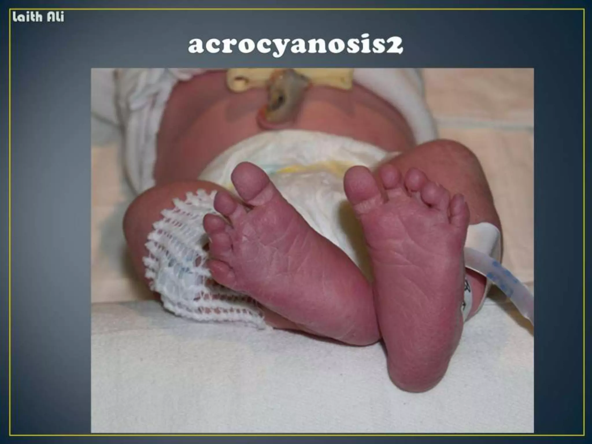 Pictures of pediatric disorders | PPSX