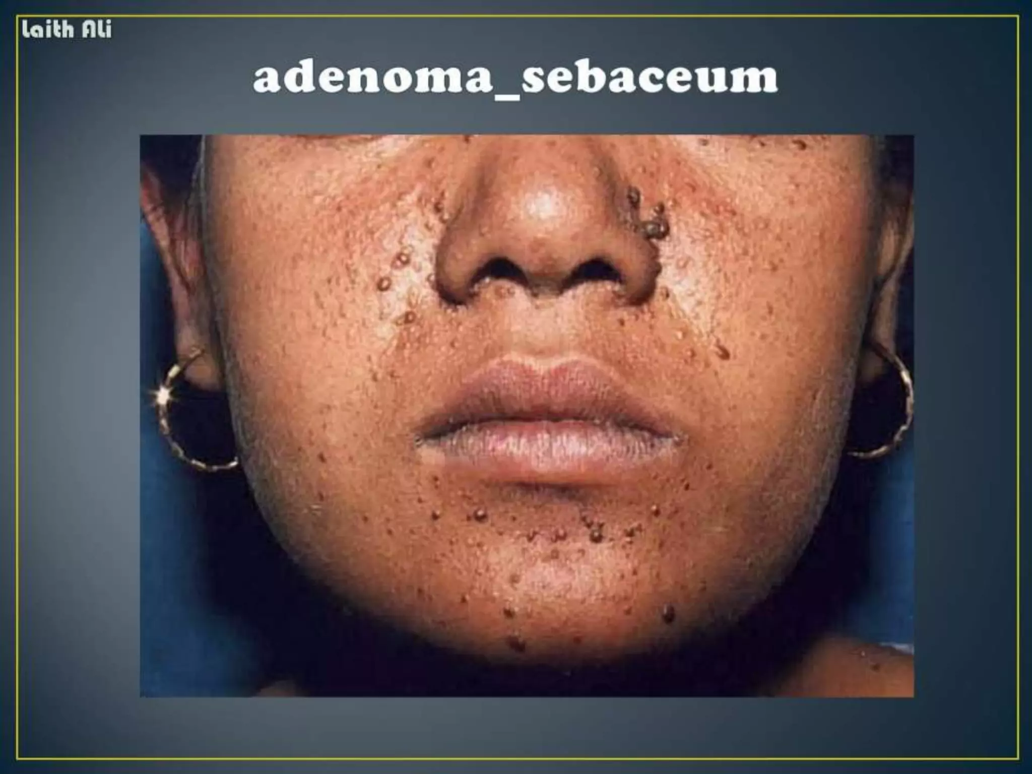 Pictures of pediatric disorders | PPSX