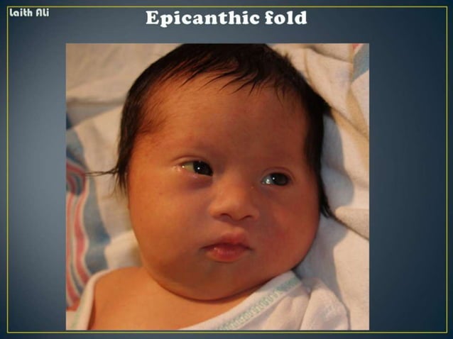 Pictures of pediatric disorders | PPSX | Medical Health