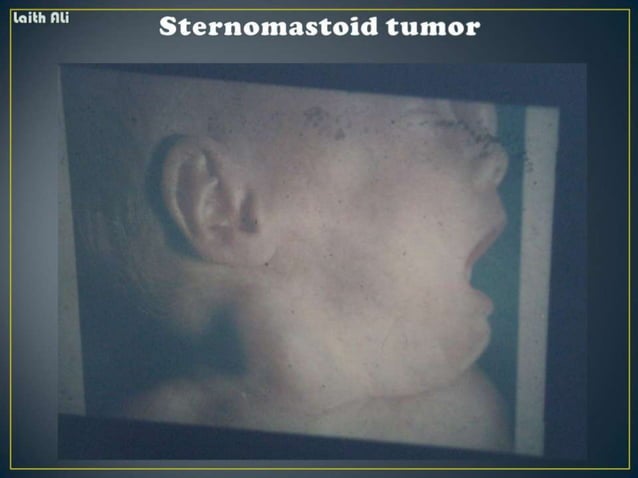 Pictures of pediatric disorders | PPSX | Medical Health