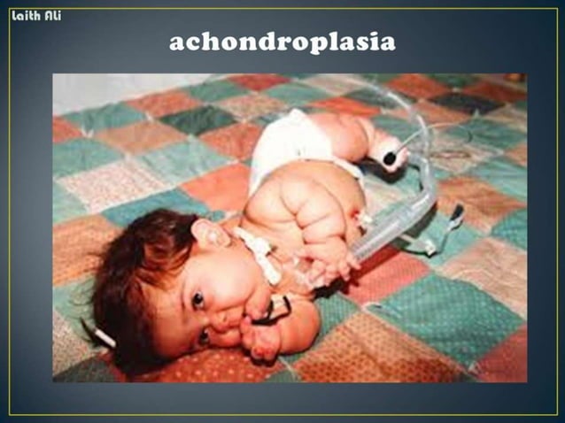 Pictures of pediatric disorders | PPSX | Medical Health