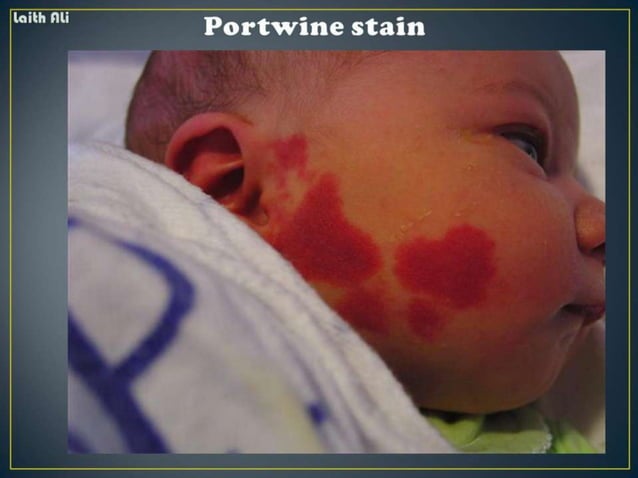 Pictures of pediatric disorders | PPSX | Medical Health