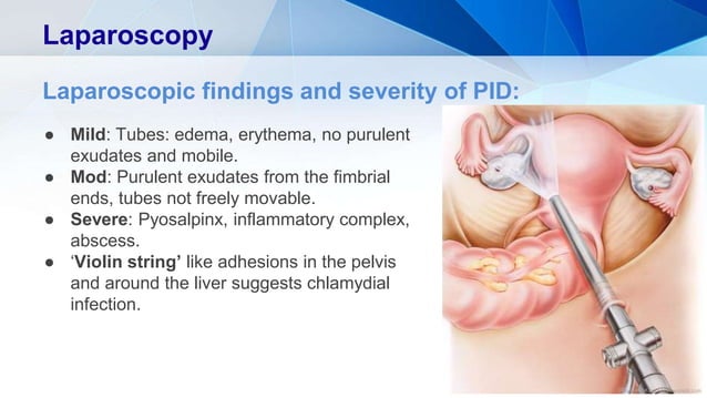 PELVIC INFLAMMATORY DISEASE (PID) | PPTX | Reproductive Health | Diseases and Conditions