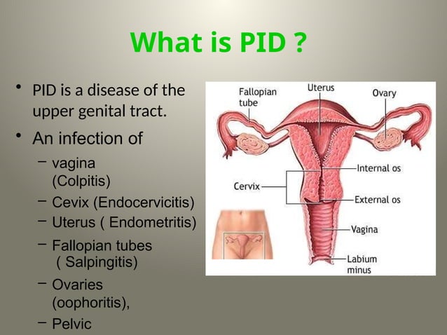 PID.pptx pelvic inflammatory diseases obg | PPTX
