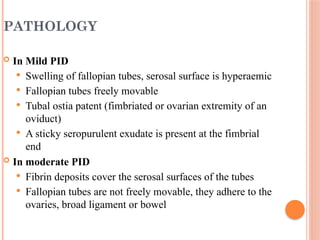 Pelvic inflammation disease power point presentation | PPT