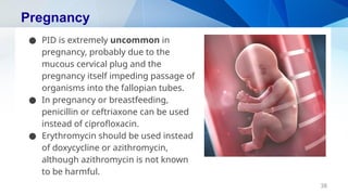 Comprehensive Overview of Pelvic Inflammatory Disease (PID ...