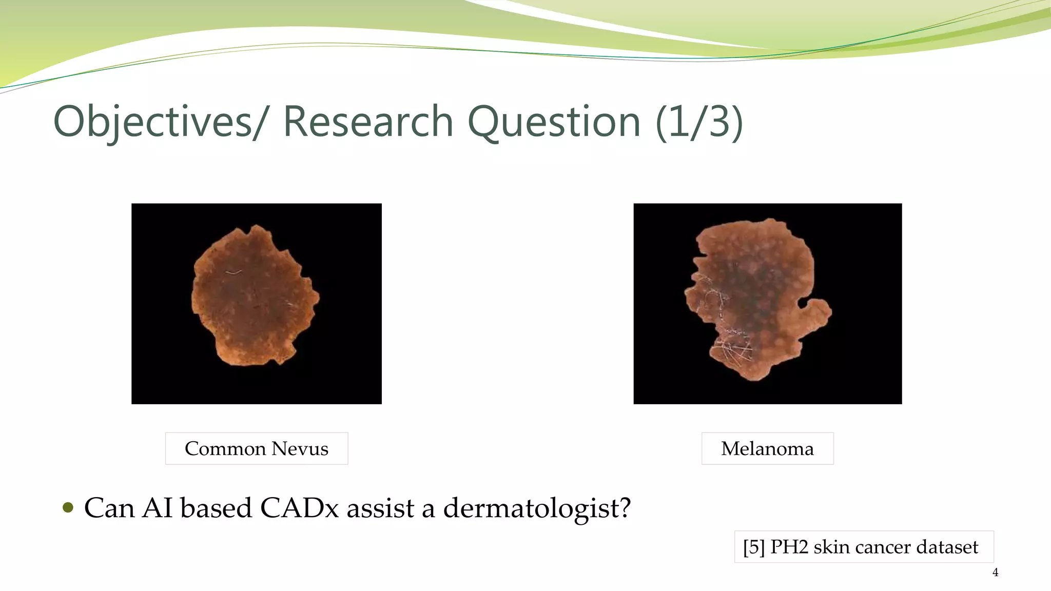 Automatic Skin Lesion Segmentation And Melanoma Detection Transfer