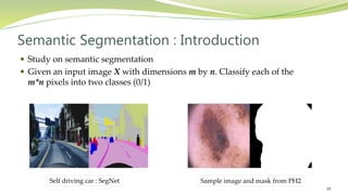 Automatic Skin Lesion Segmentation and Melanoma Detection: Transfer ...