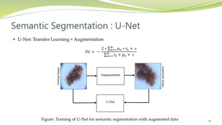 Automatic Skin Lesion Segmentation and Melanoma Detection: Transfer Learning approach with U-Net ...