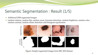 Automatic Skin Lesion Segmentation and Melanoma Detection: Transfer Learning approach with U-Net ...