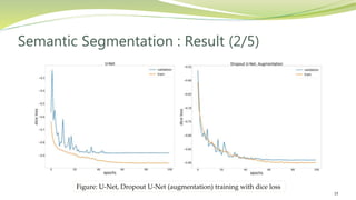 Automatic Skin Lesion Segmentation and Melanoma Detection: Transfer Learning approach with U-Net ...