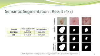 Automatic Skin Lesion Segmentation and Melanoma Detection: Transfer Learning approach with U-Net ...