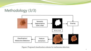 Automatic Skin Lesion Segmentation and Melanoma Detection: Transfer ...