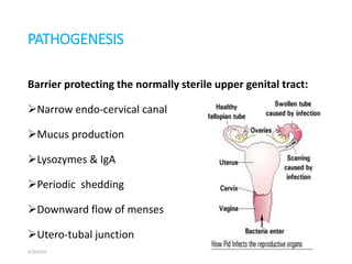 Seminar presentation of PID and ectopic pregnancy.pptx