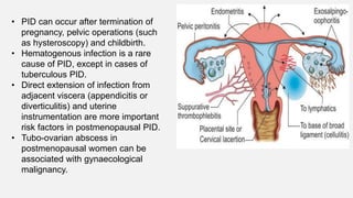 Pid by dr naz pptx | PPT