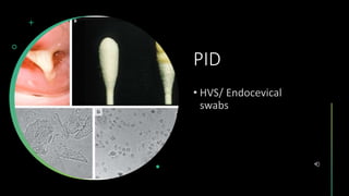 PID ppt.pptx | Reproductive Health | Diseases and Conditions