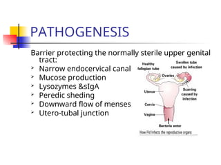 Pelvic inflammatory diseases PowerPoint.ppt
