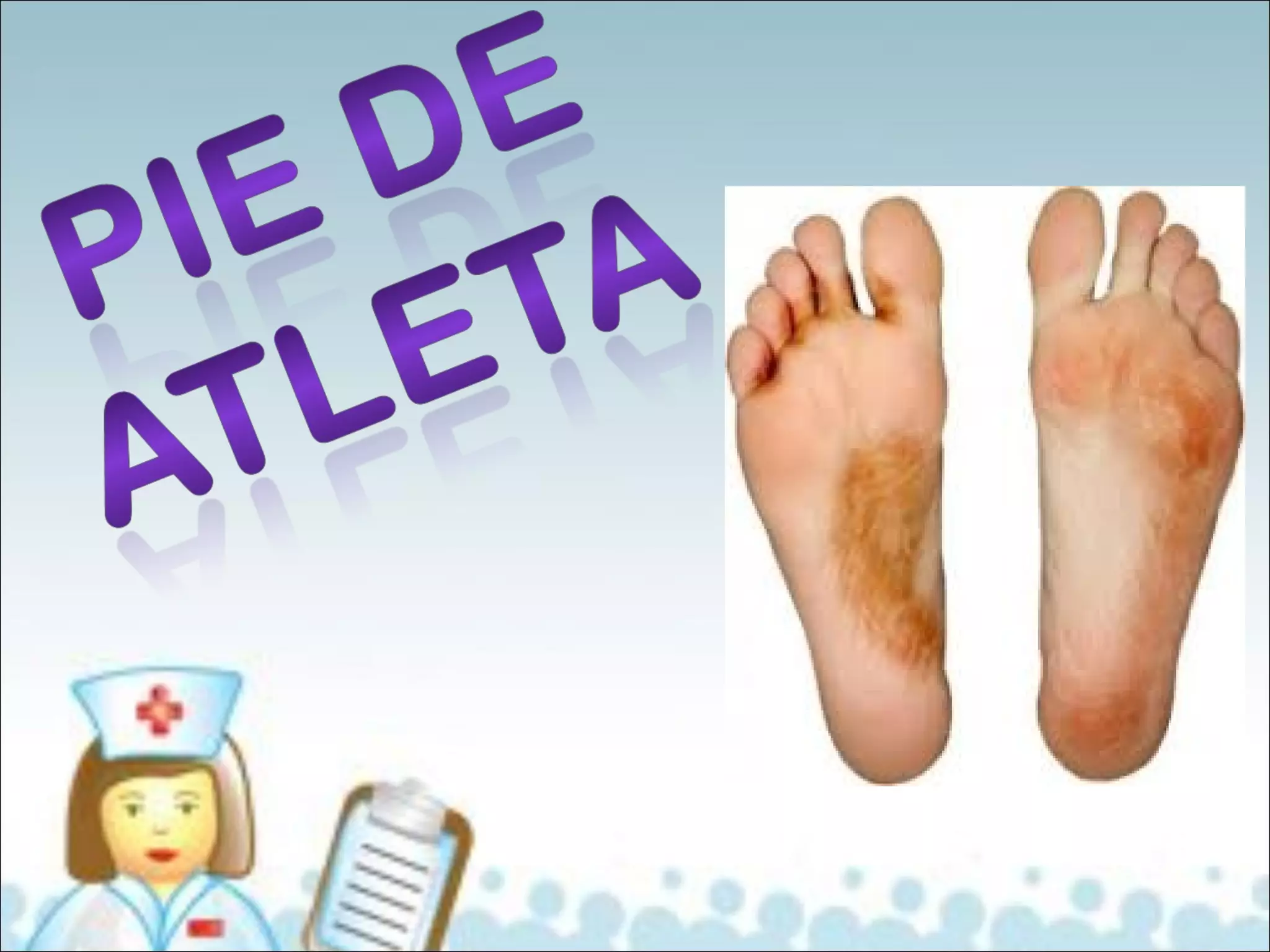 Pie de atleta | PPT