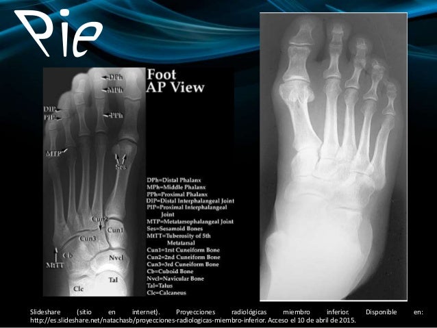 Radiología del Pie