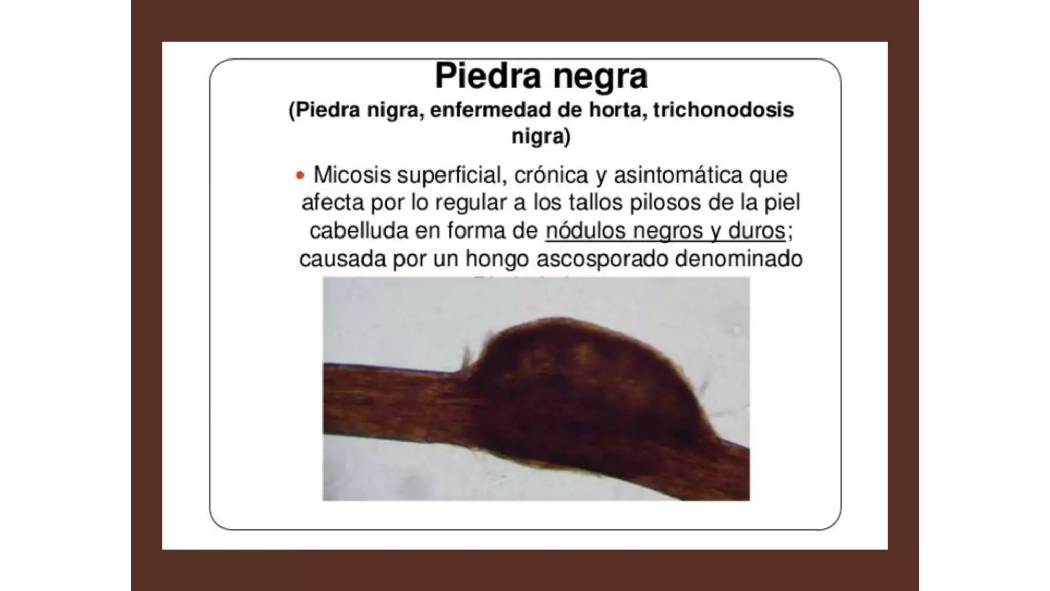 Piedra negra micologia | PPT