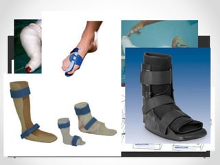 Pie equino varo | PPTX