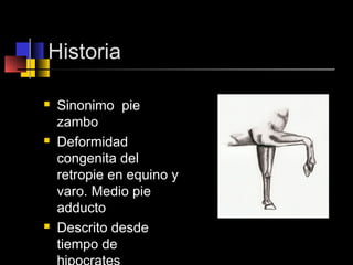 Pie equino varo-adducto congénito | PPT