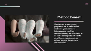 Pie equino varo. | PDF