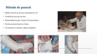 PIE EQUINOVARO CONGENITO EN PEDIATRIA.pptx