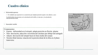 PIE EQUINOVARO CONGENITO EN PEDIATRIA.pptx