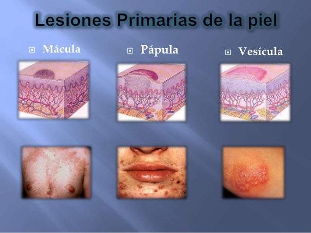 exploracion fisica de Piel