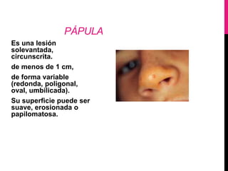 Exploracion de Piel y Anexos | PPTX
